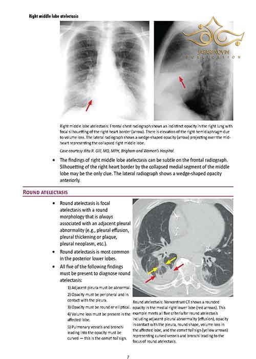 کتاب Core Radiology: A Visual Approach to Diagnostic Imaging 1st ...