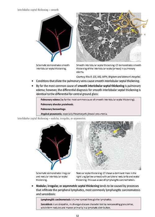 کتاب Core Radiology: A Visual Approach to Diagnostic Imaging 1st ...